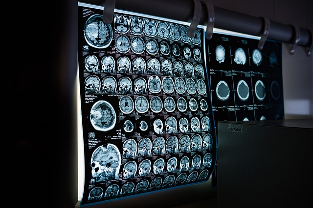 Laser-Driven CT Scans Revolutionize Imaging – MedTechNews